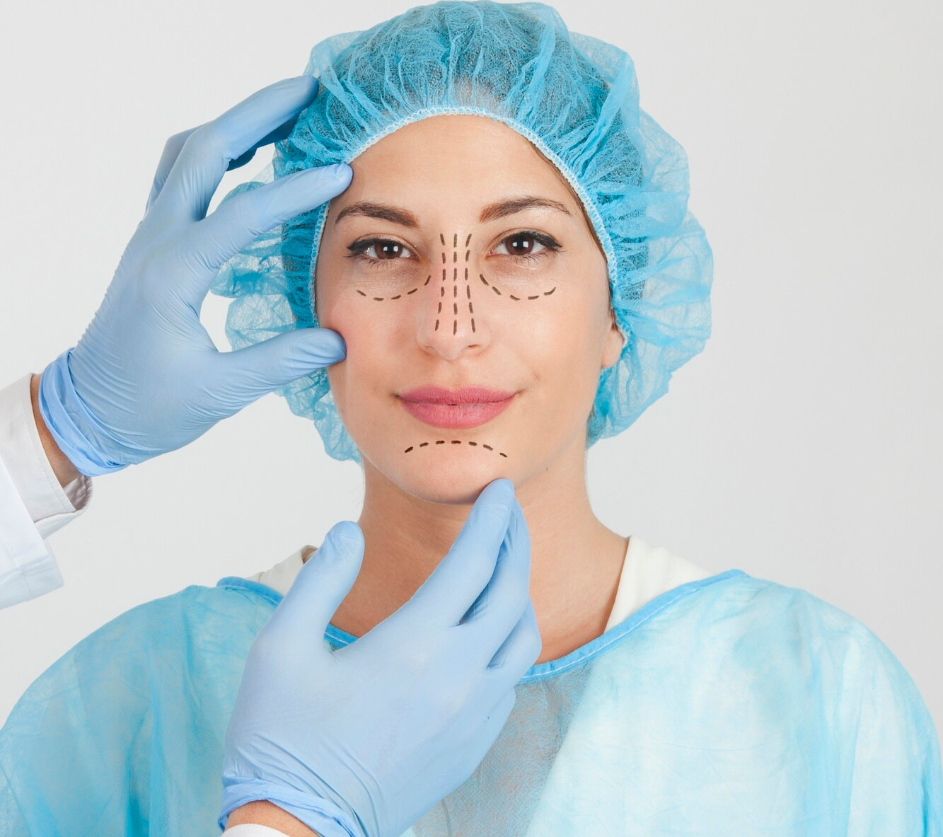 Best Thread Lift Treatment in Hyderabad - Sikara Clinics